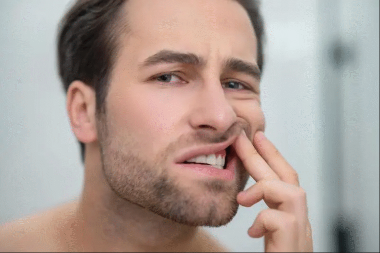 Roof of Mouth Hurts Sinus: Causes, Symptoms, and Effective Relief ...